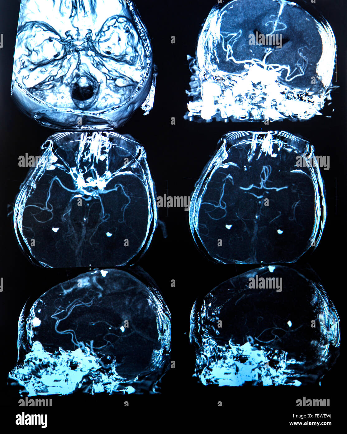 X ray images Stock Photo - Alamy