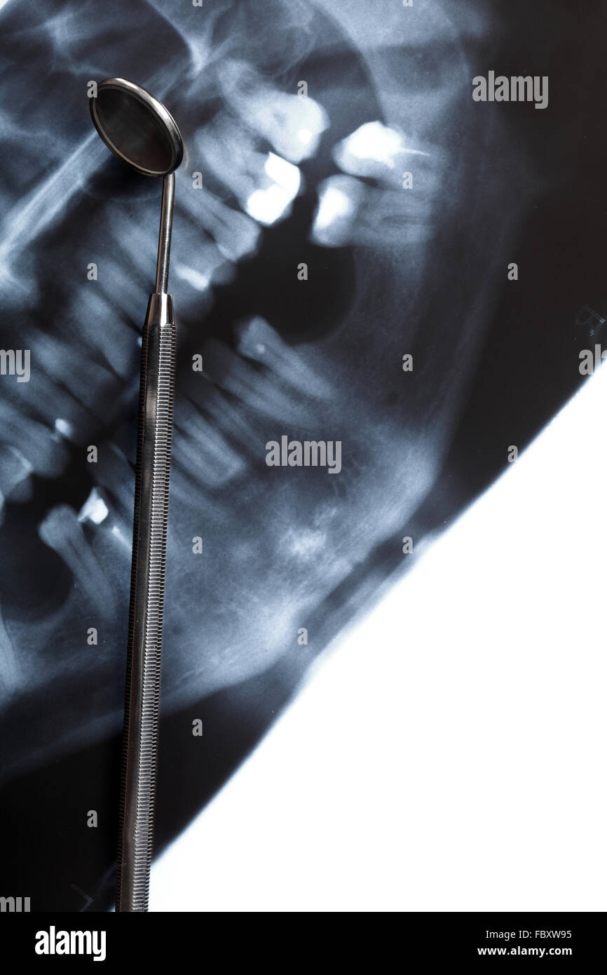 X ray of humans hi-res stock photography and images - Alamy