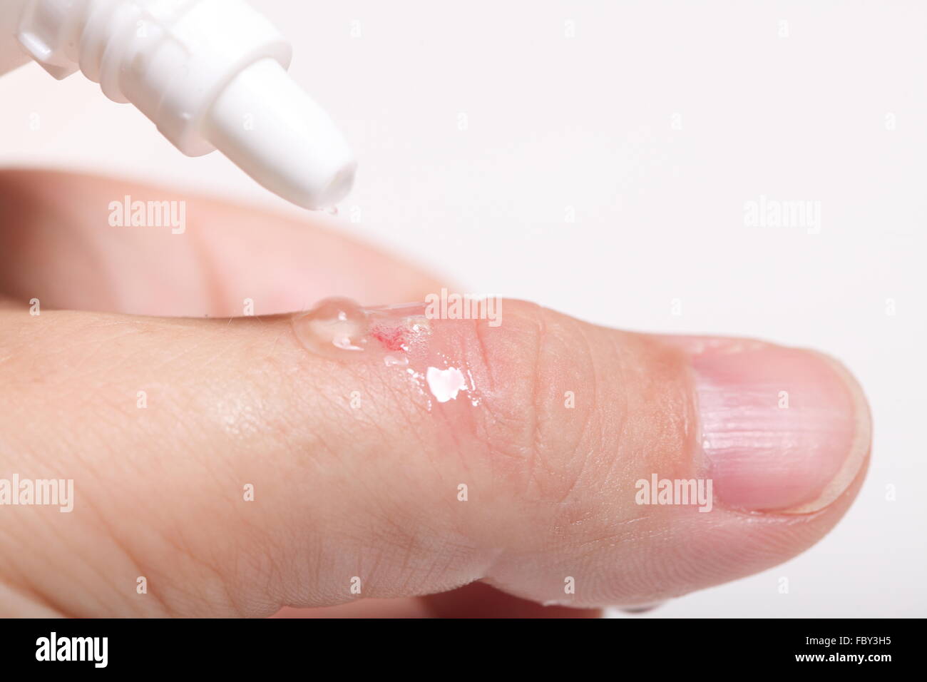 Human blood smear hi-res stock photography and images - Alamy