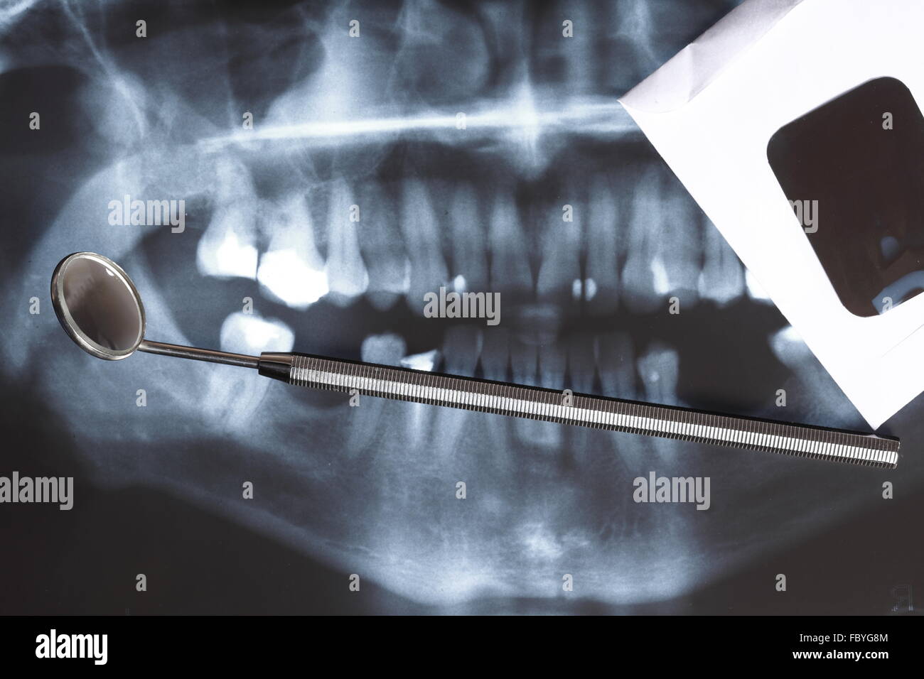 X ray of humans hi-res stock photography and images - Alamy
