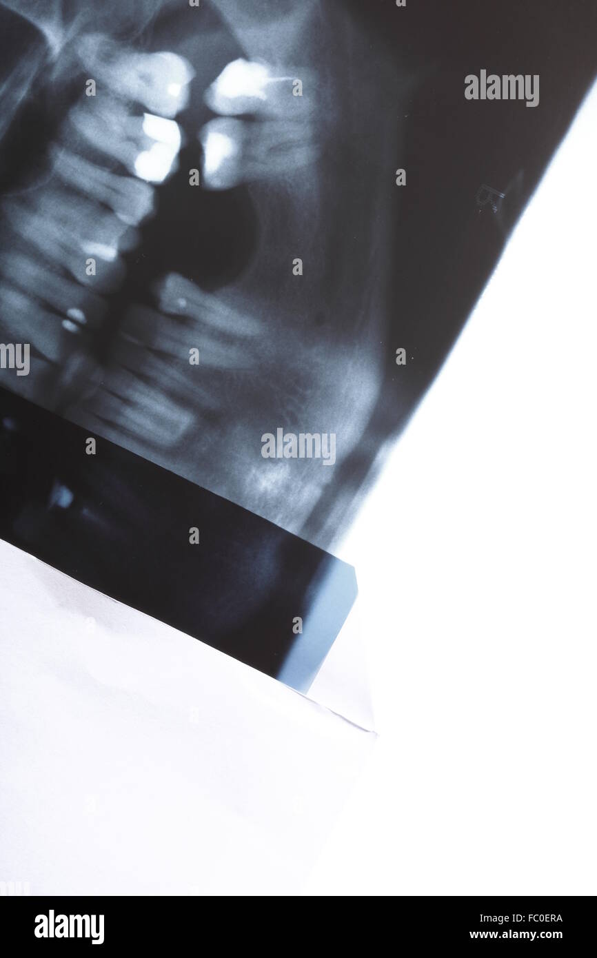 Medical scan hi-res stock photography and images - Alamy