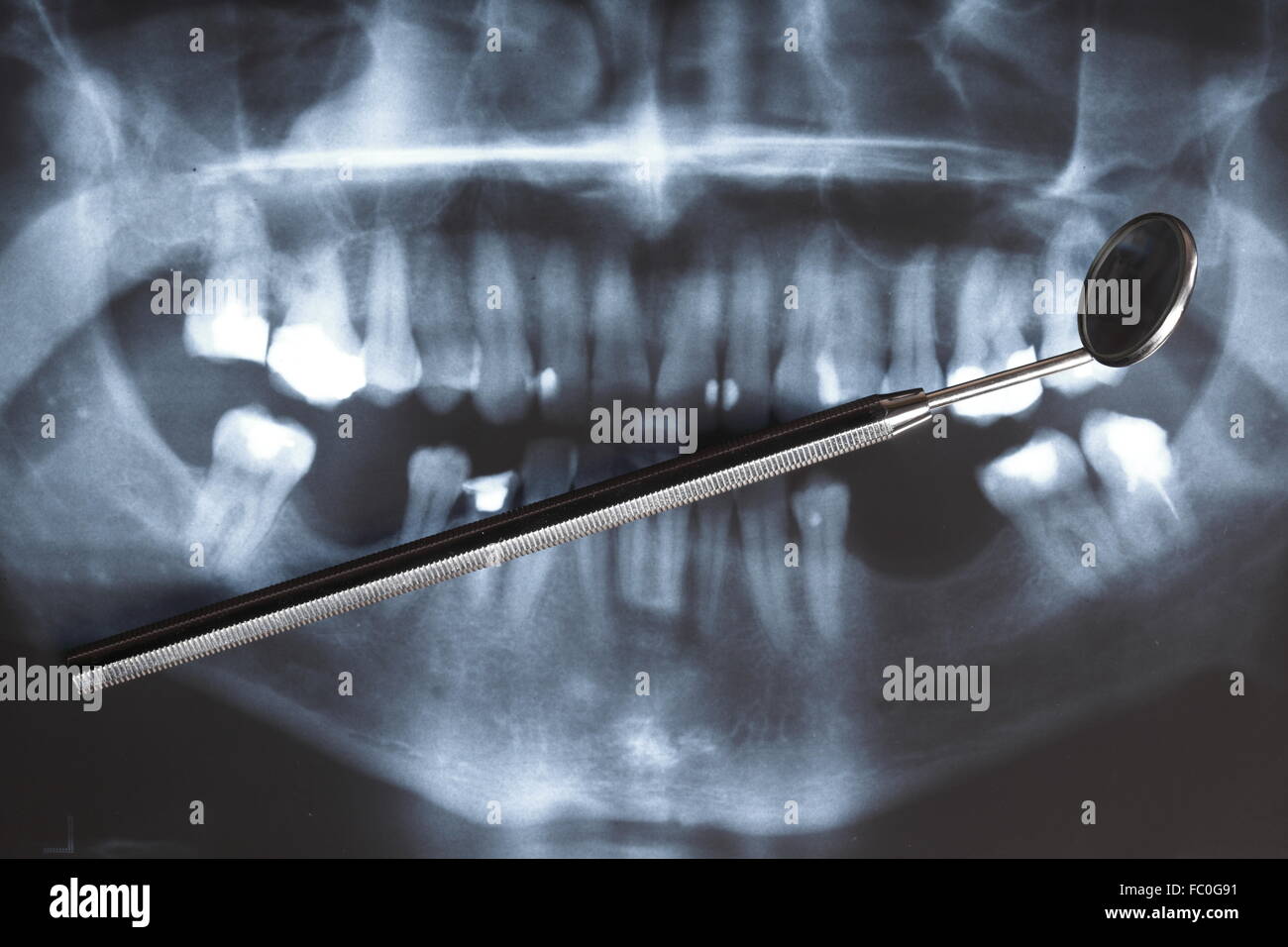 X ray of humans hi-res stock photography and images - Alamy