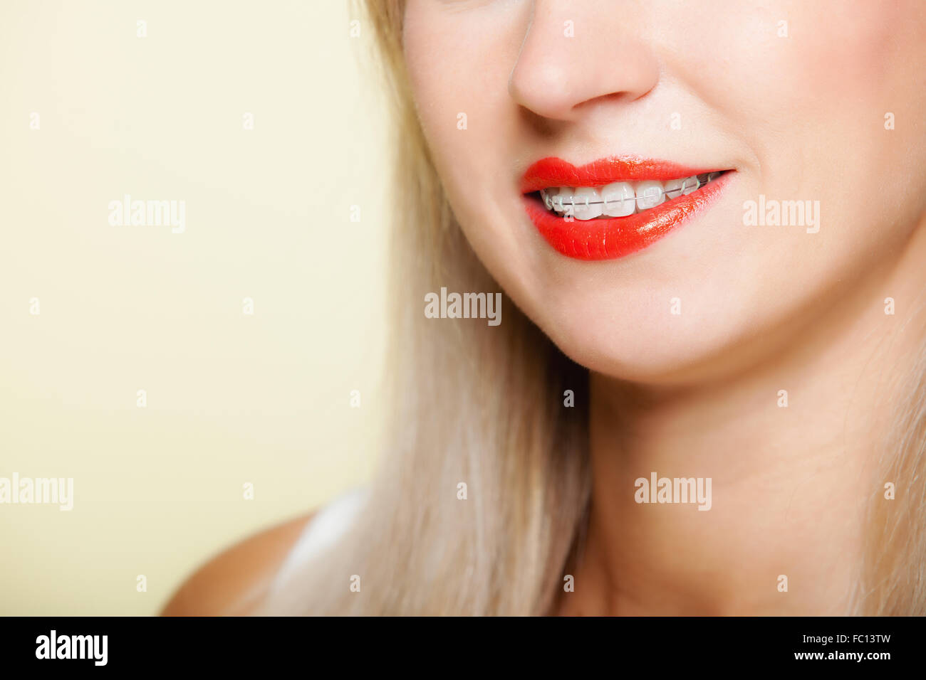 Straighten teeth hi-res stock photography and images - Alamy