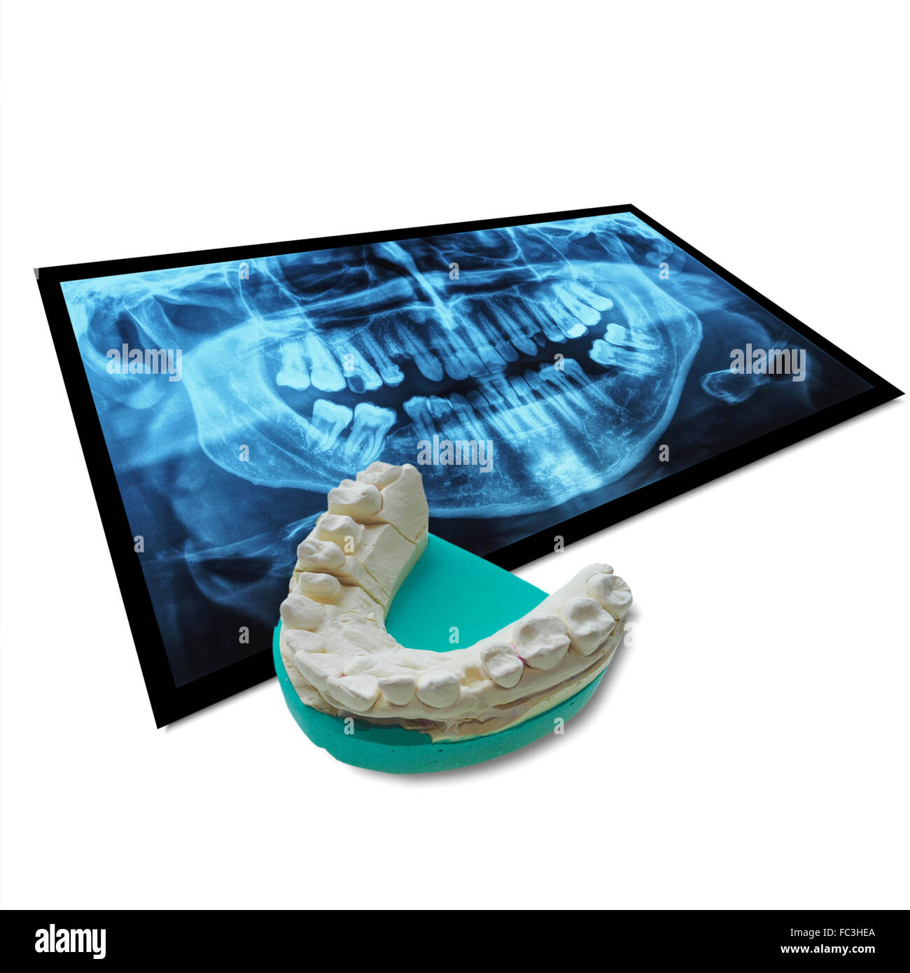 Body cast hospital hi-res stock photography and images - Alamy