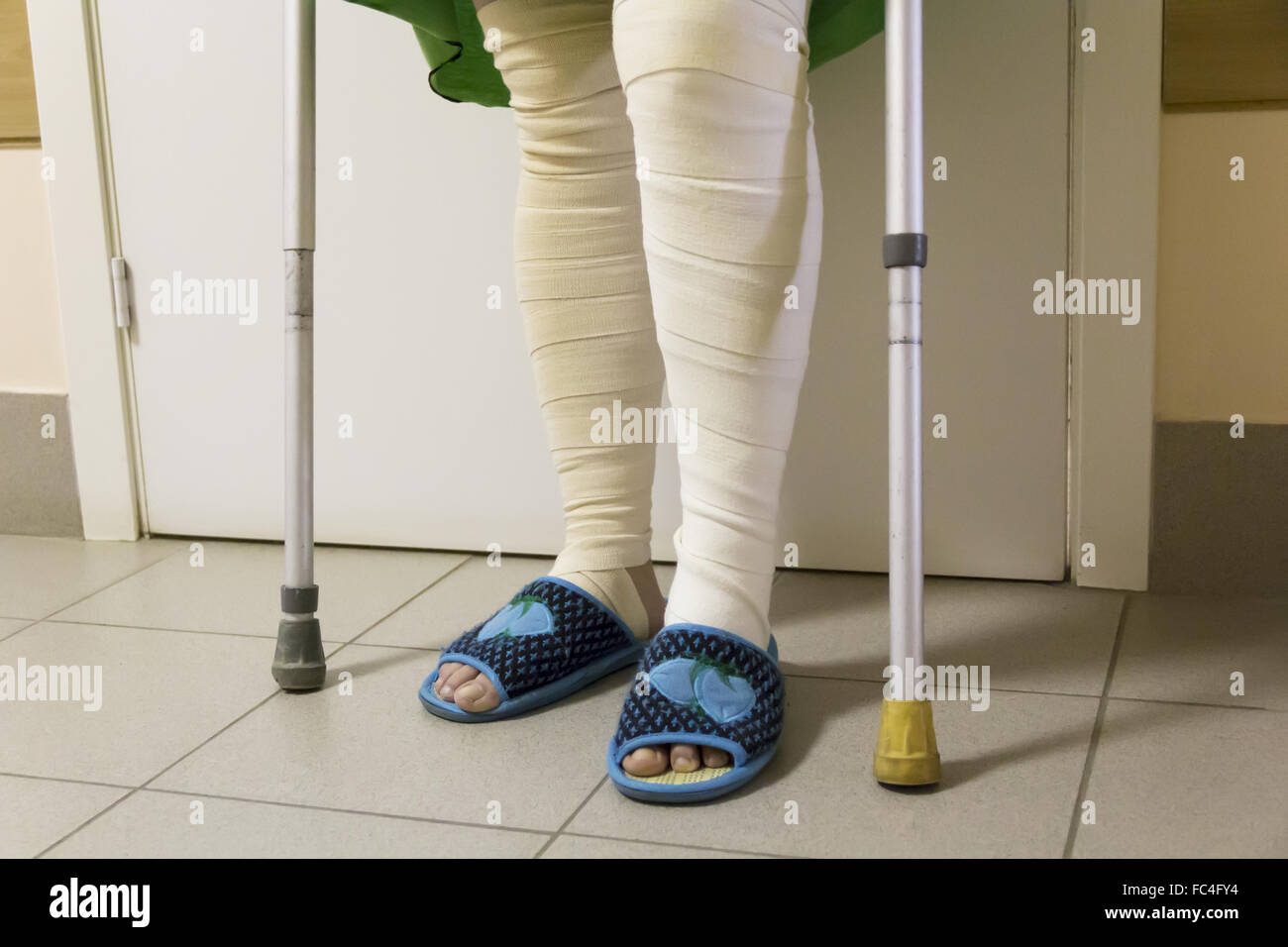 Stick legs hi-res stock photography and images - Alamy