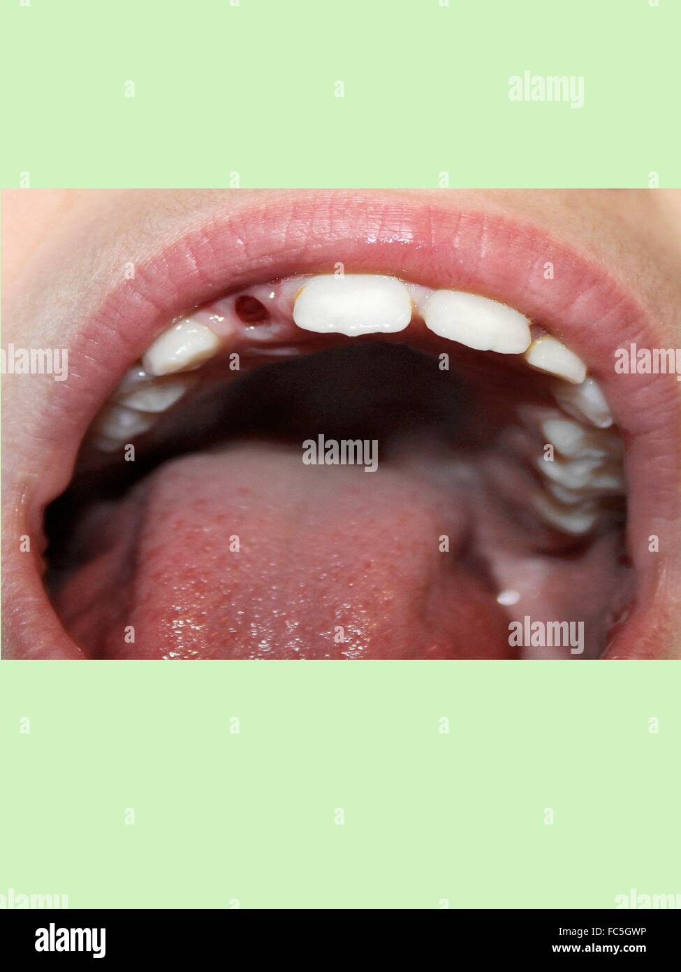 mouth of a child without a tooth Stock Photo - Alamy