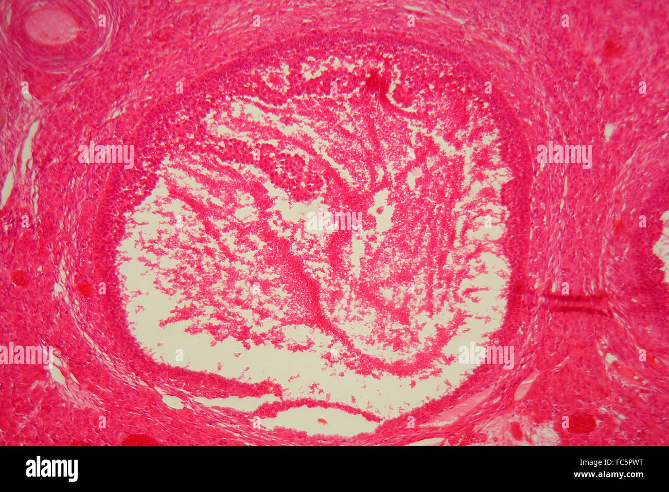 Ovary tissue under the microscope Stock Photo - Alamy