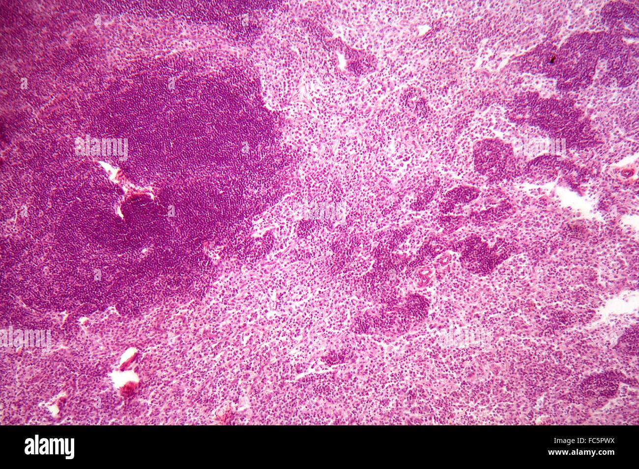 Lymph node under the microscope Stock Photo - Alamy