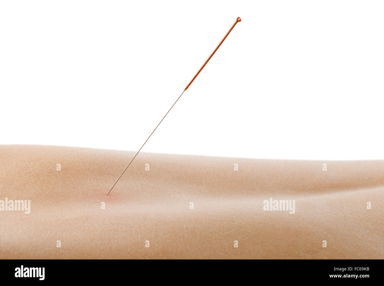 Acupuncture hi-res stock photography and images - Alamy