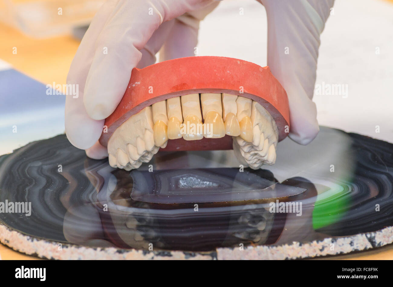 Oral prosthesis hi-res stock photography and images - Alamy