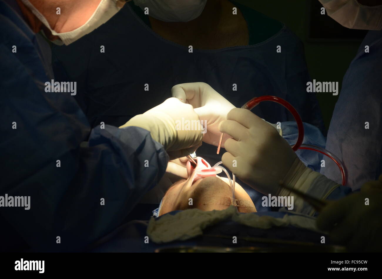 Rio de Janeiro, Brazil. 14th Jan, 2016. A patient undergoes plastic ...