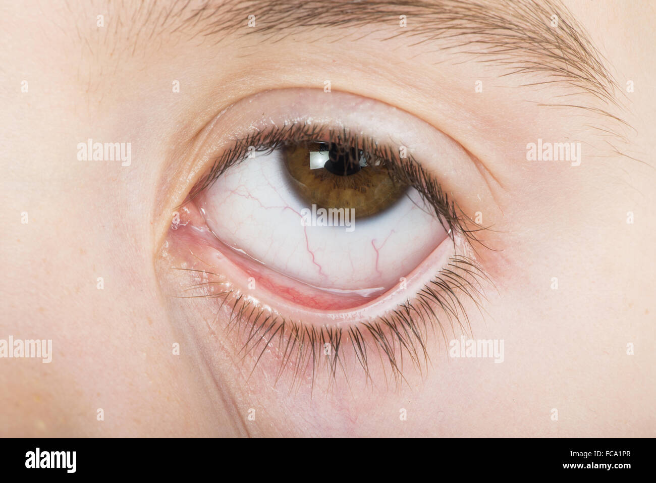 Human eye wide open Stock Photo - Alamy
