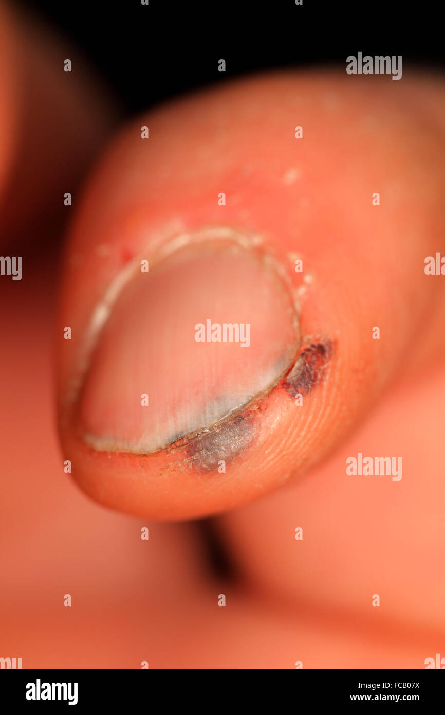 Finger showing nails hi-res stock photography and images - Alamy