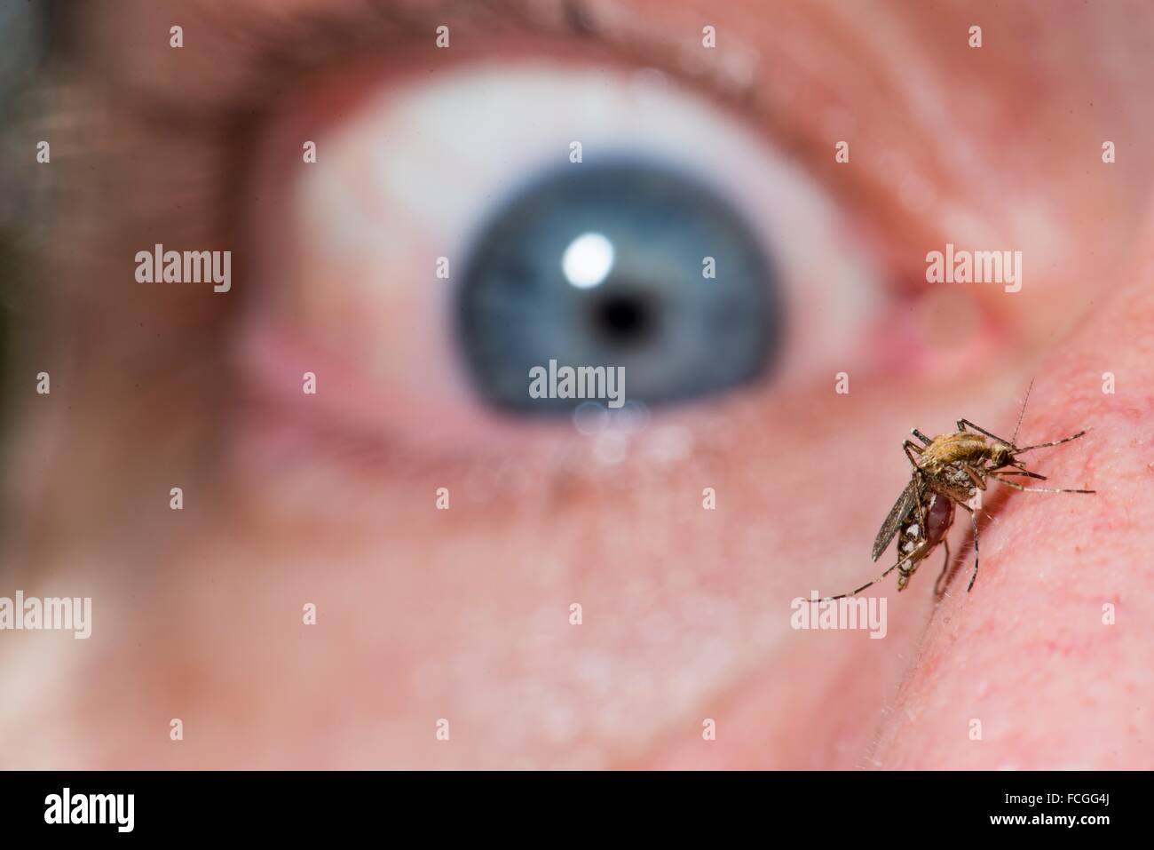 Mosquito Bites On Eye