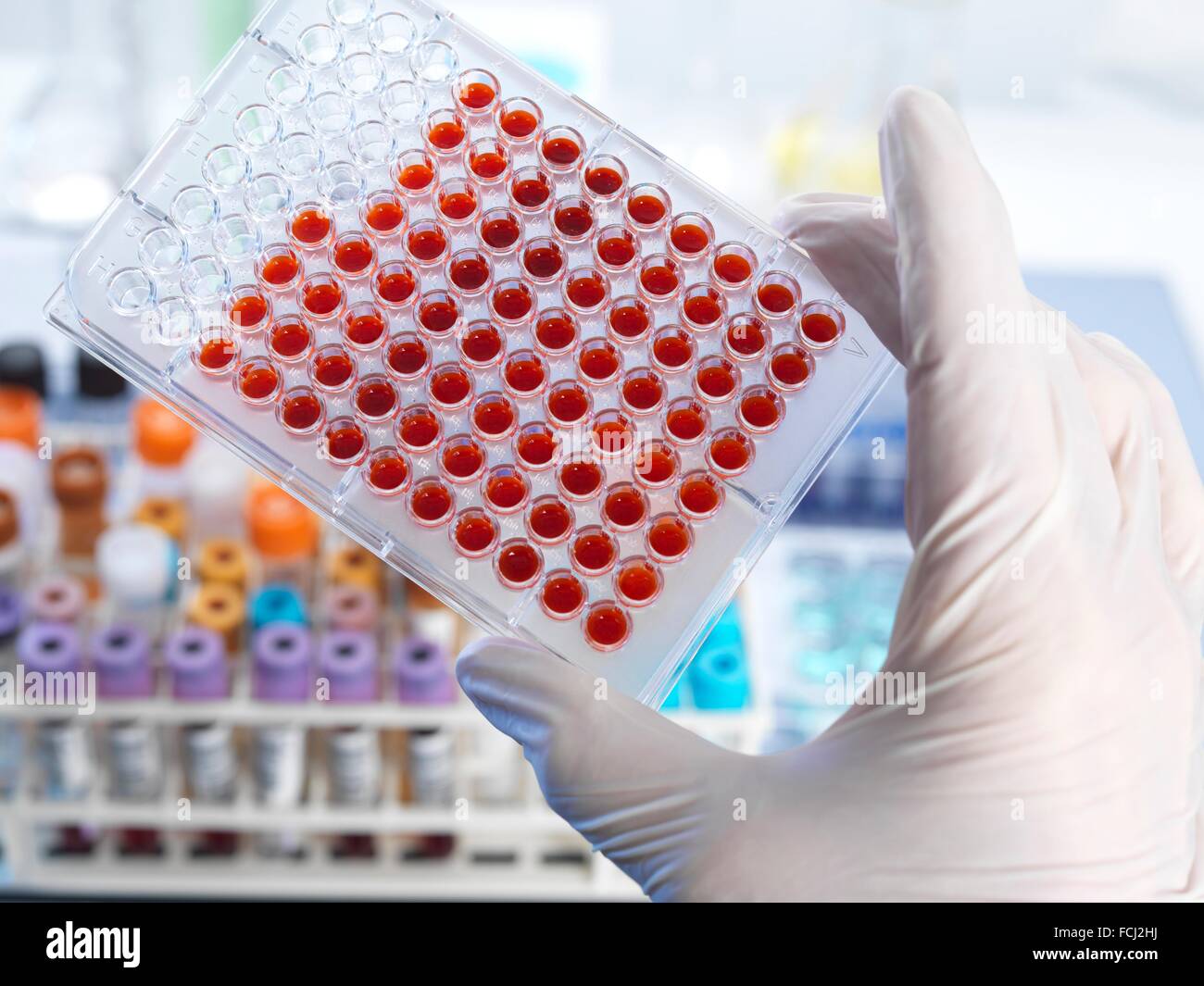 PROPERTY RELEASED. MODEL RELEASED. Blood screening. Scientist preparing ...