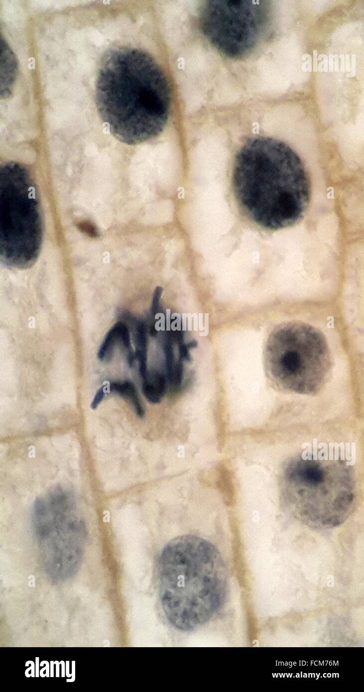 Prophase Onion Root Tip