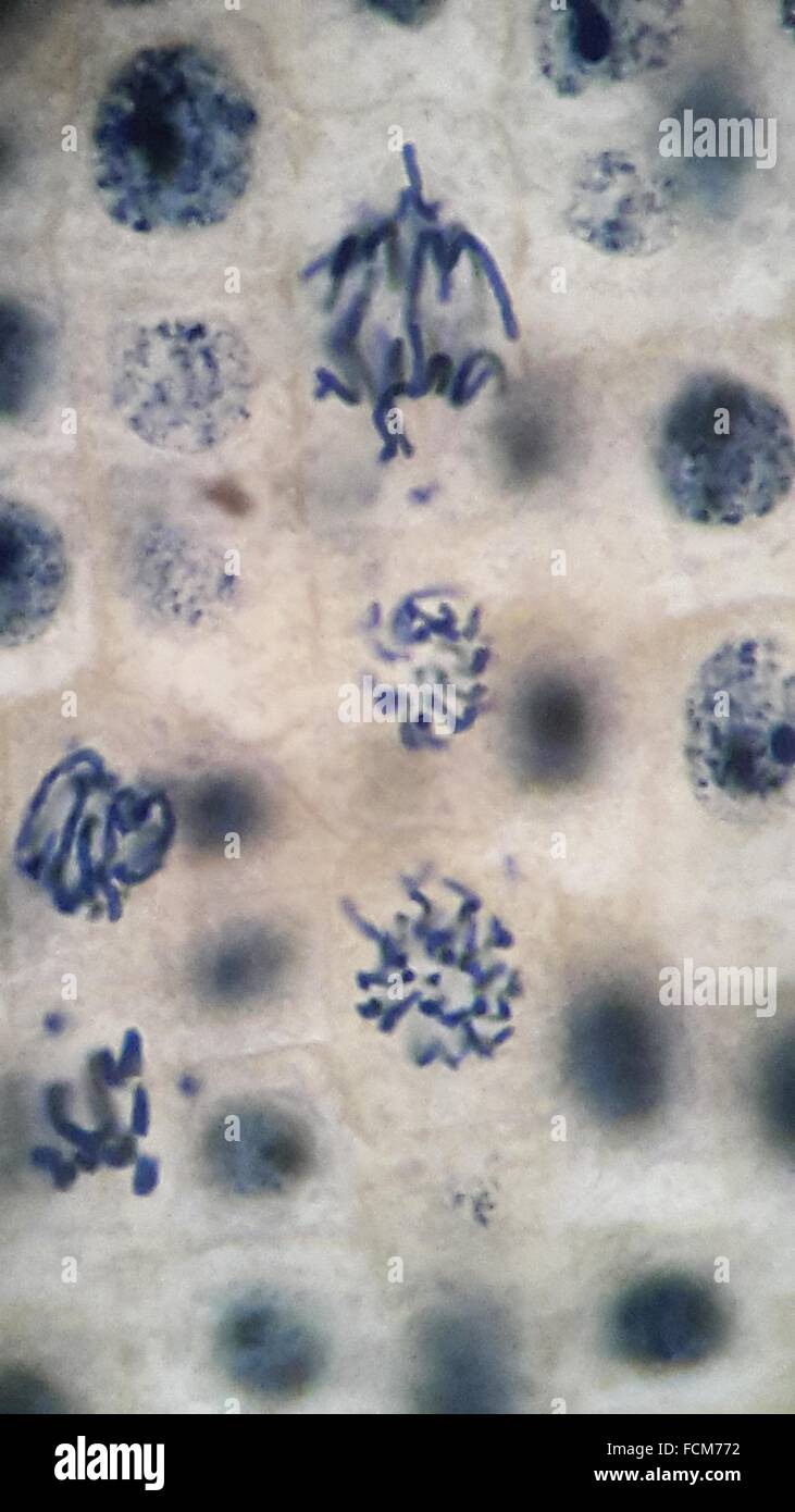 Cell in the prophase stage of mitosis hi-res stock photography and ...