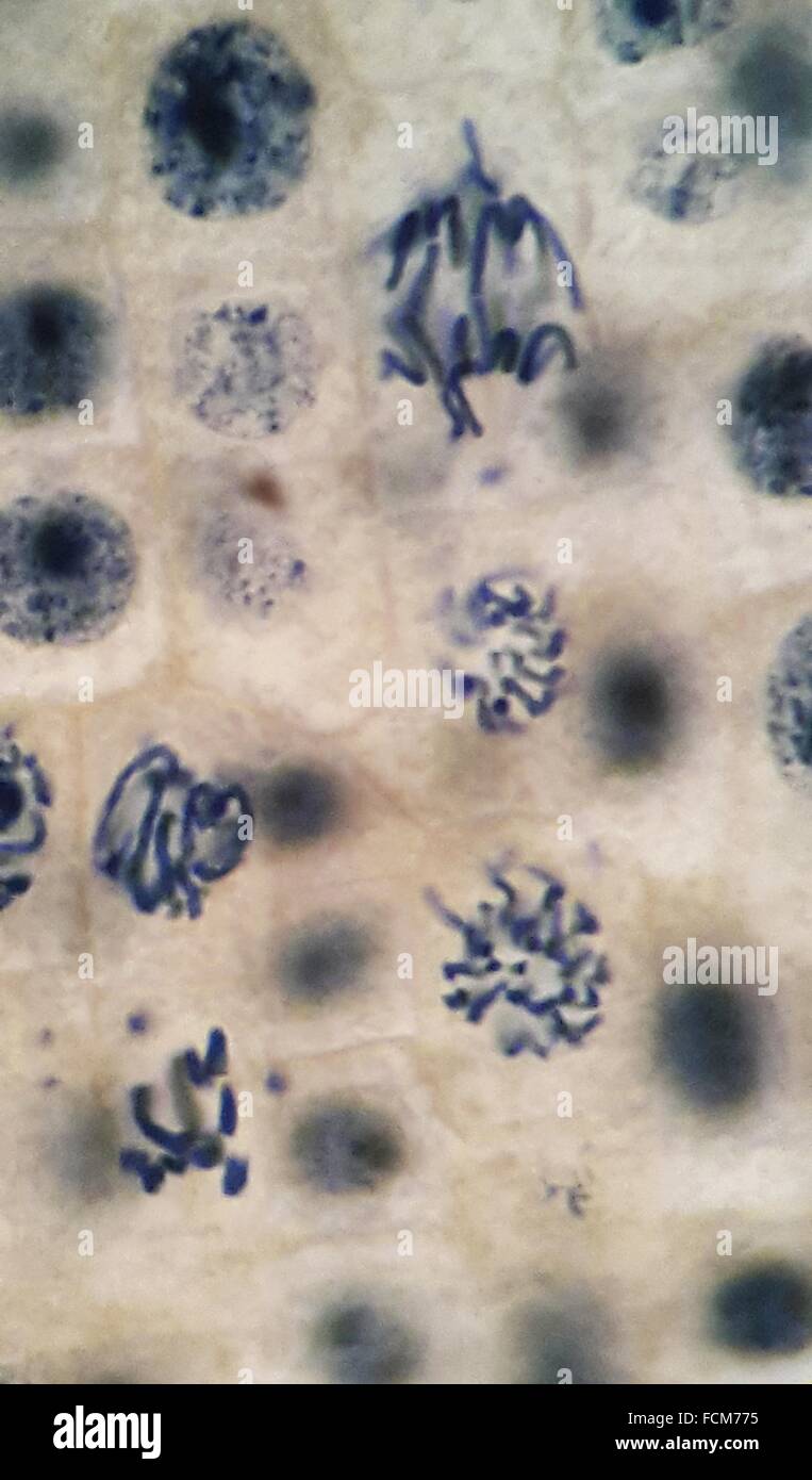 Stages Of Mitosis Under Microscope