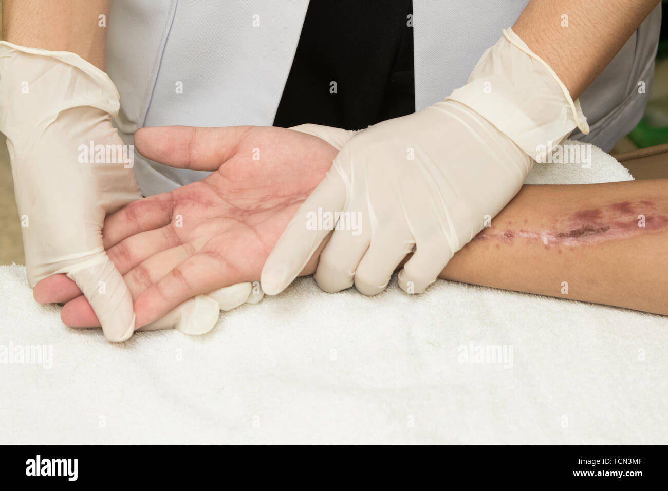 physical therapist giving hand exercise for rehabilitation Stock Photo ...