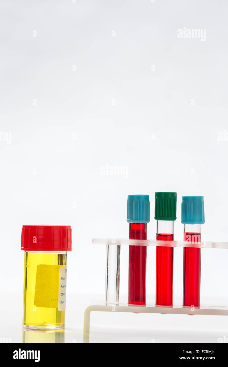 Urine Sample and Blood Test Stock Photo - Alamy