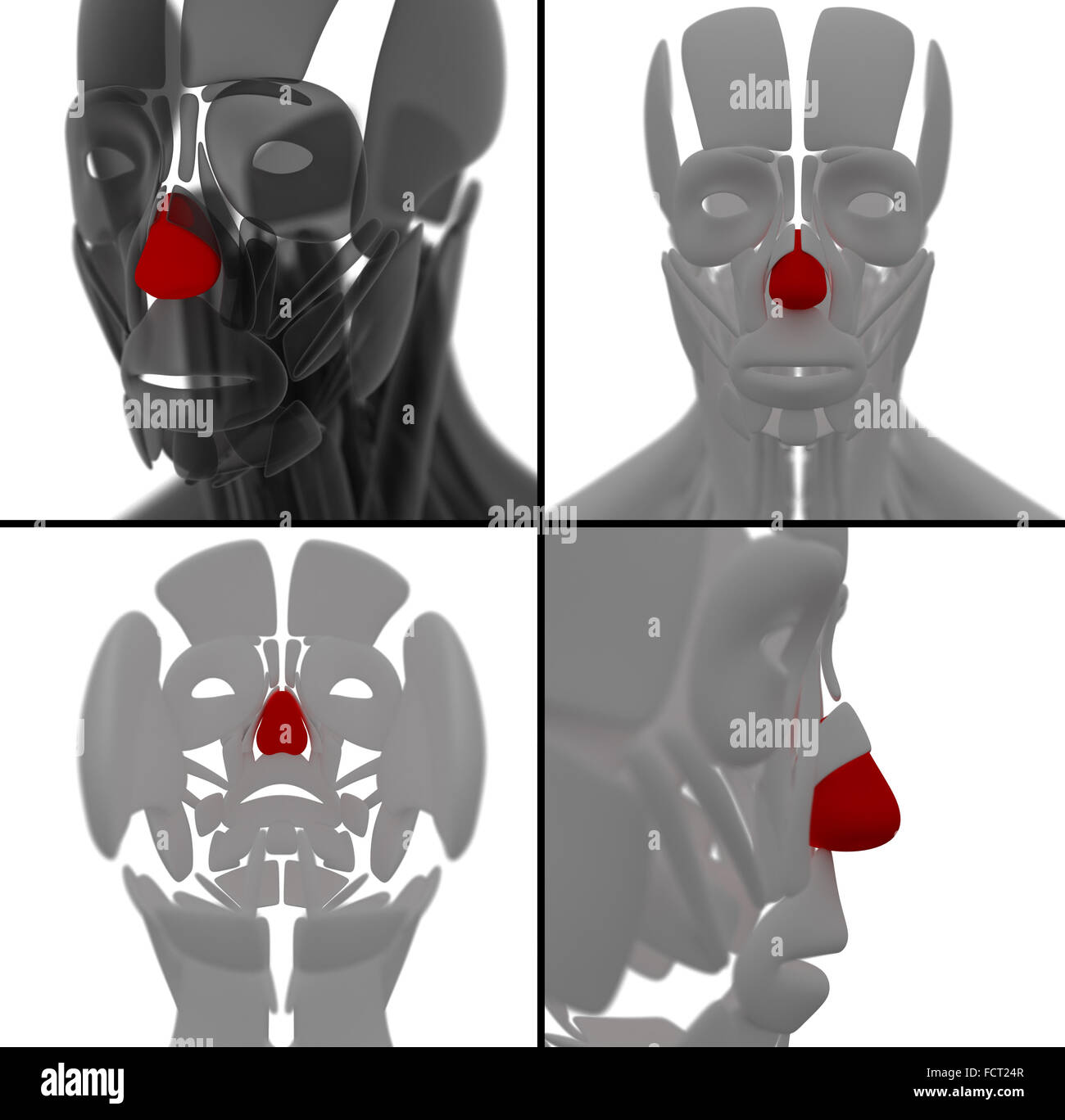 medical illustration of the Dilator Naris Stock Photo - Alamy