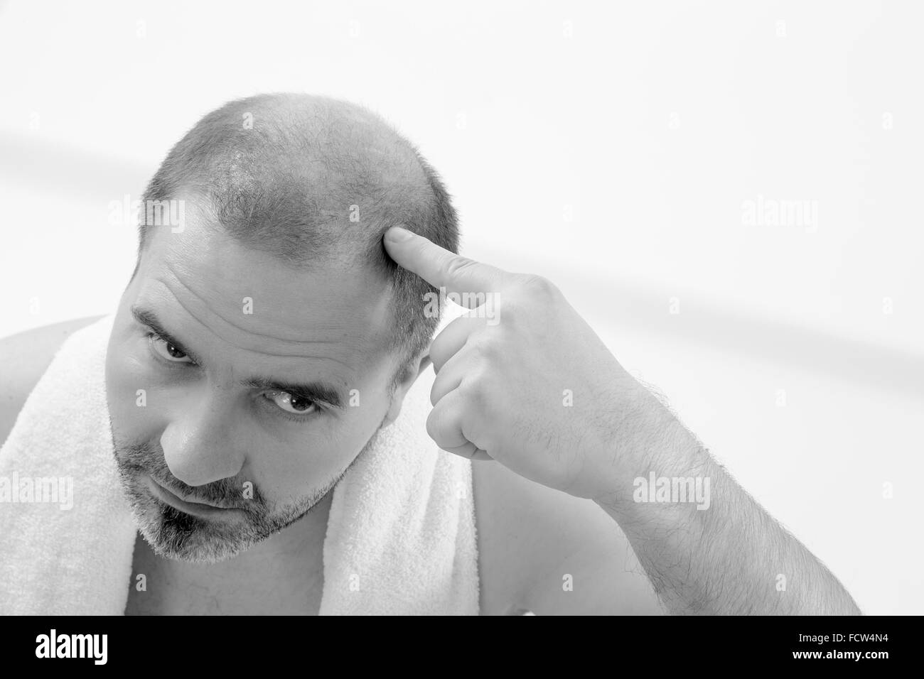 Man baldness sad Black and White Stock Photos & Images - Alamy