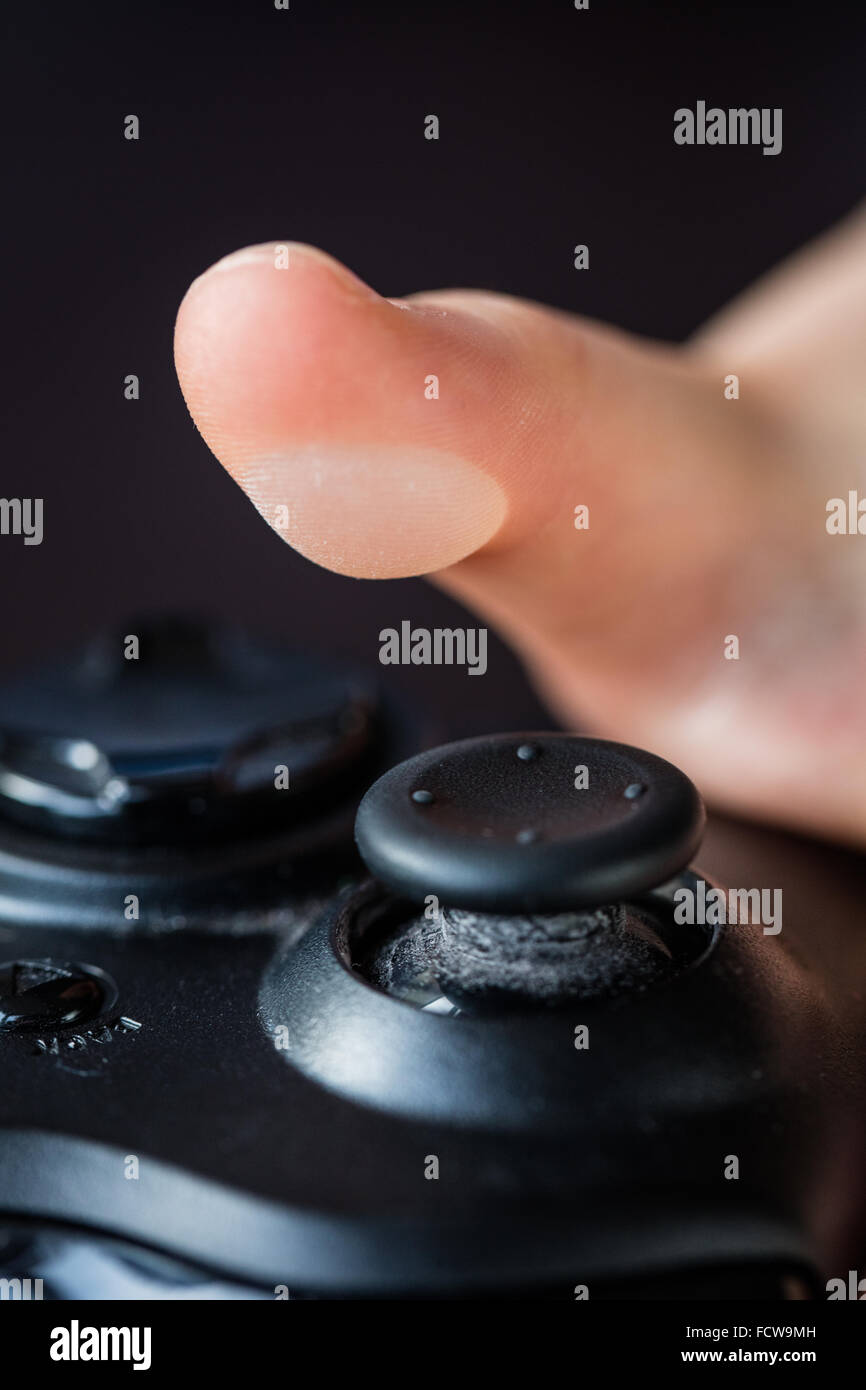 Friction blister on the left thumb of a 6 year old caucasian boy ...
