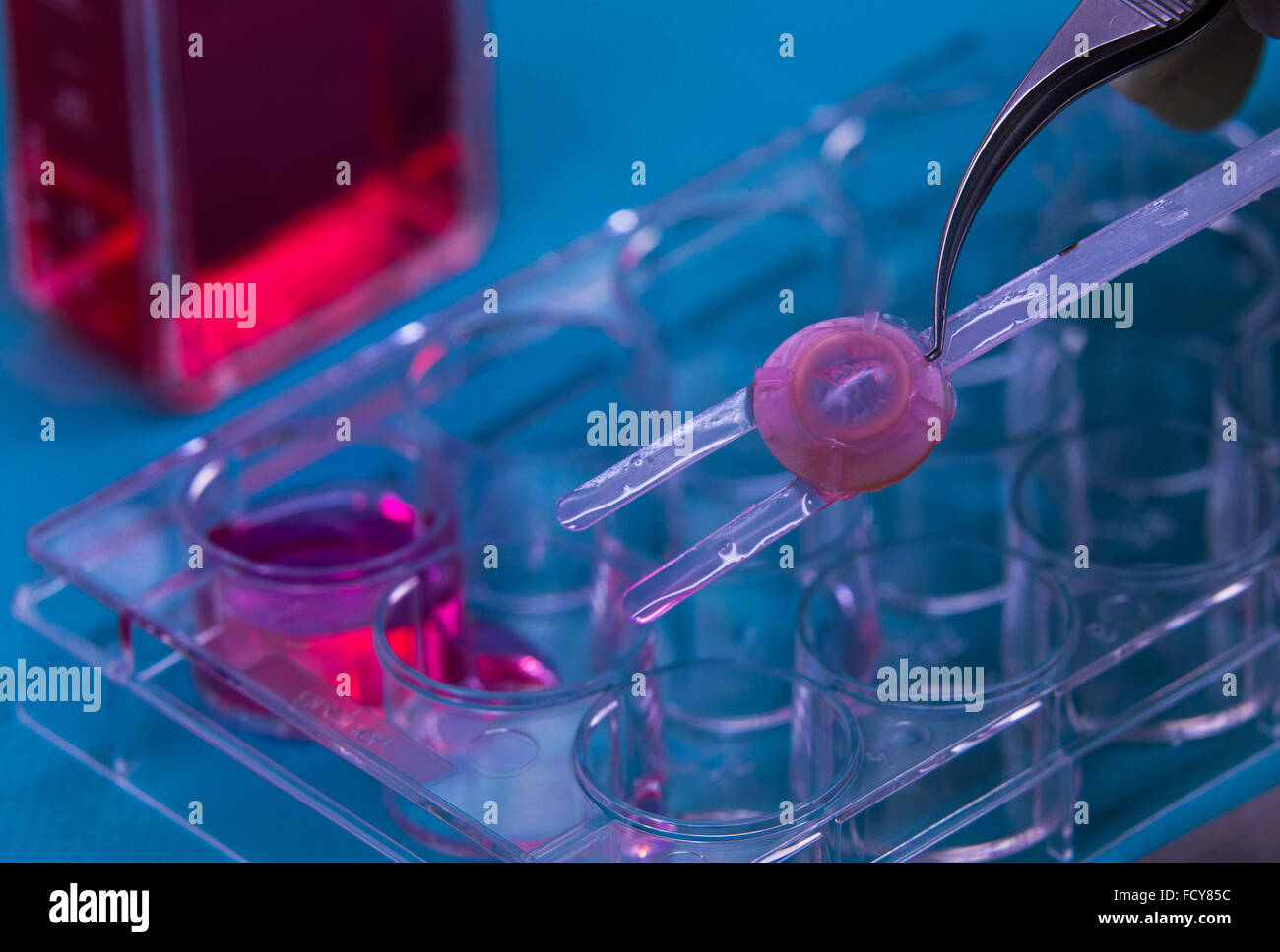 Transplant organs hi-res stock photography and images - Alamy