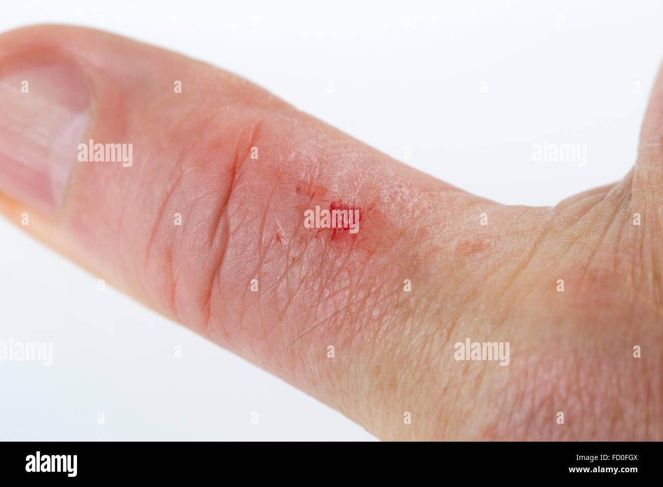 Gesture and bandage hi-res stock photography and images - Alamy