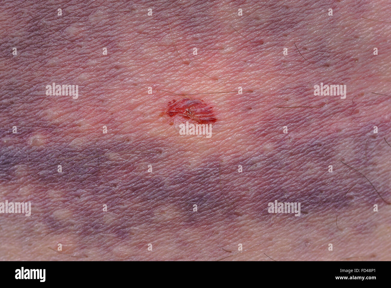 Scratch Skin Stock Photos & Scratch Skin Stock Images - Alamy