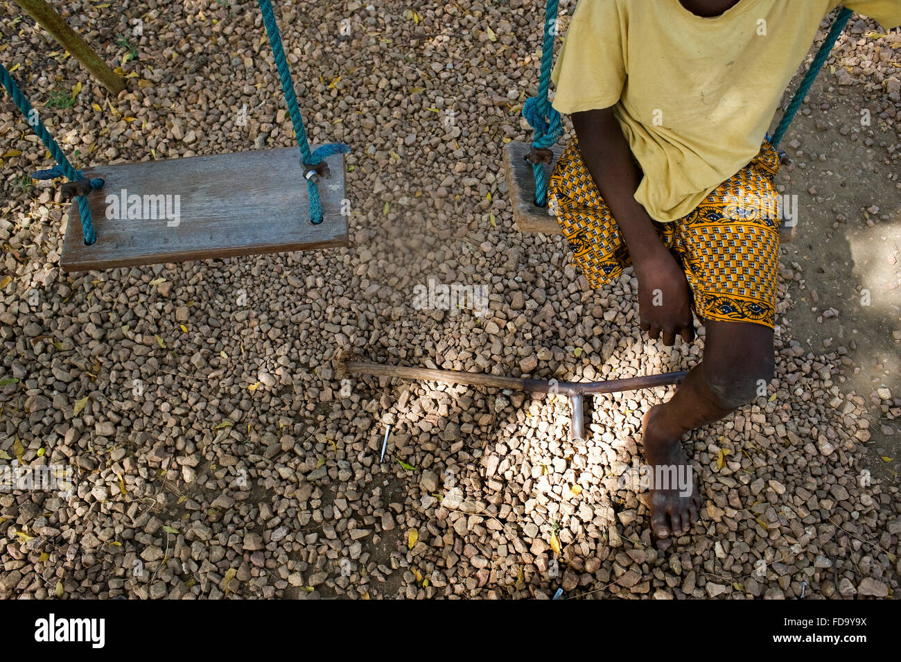 The young Tami Magnime who had his leg amputated after an accident that ...