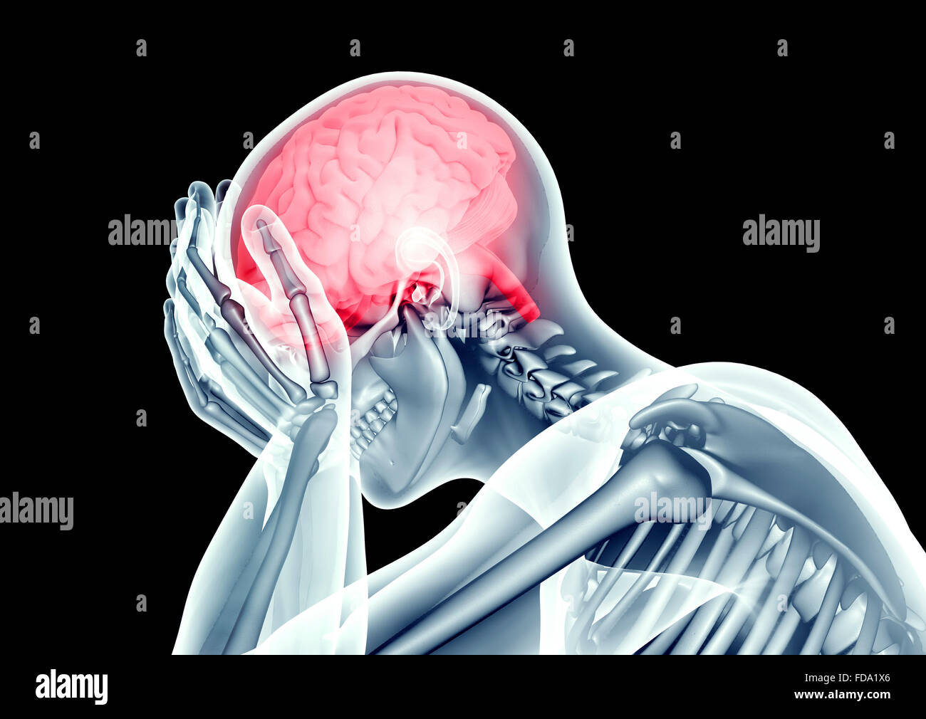 x-ray image human head with headache pain Stock Photo - Alamy