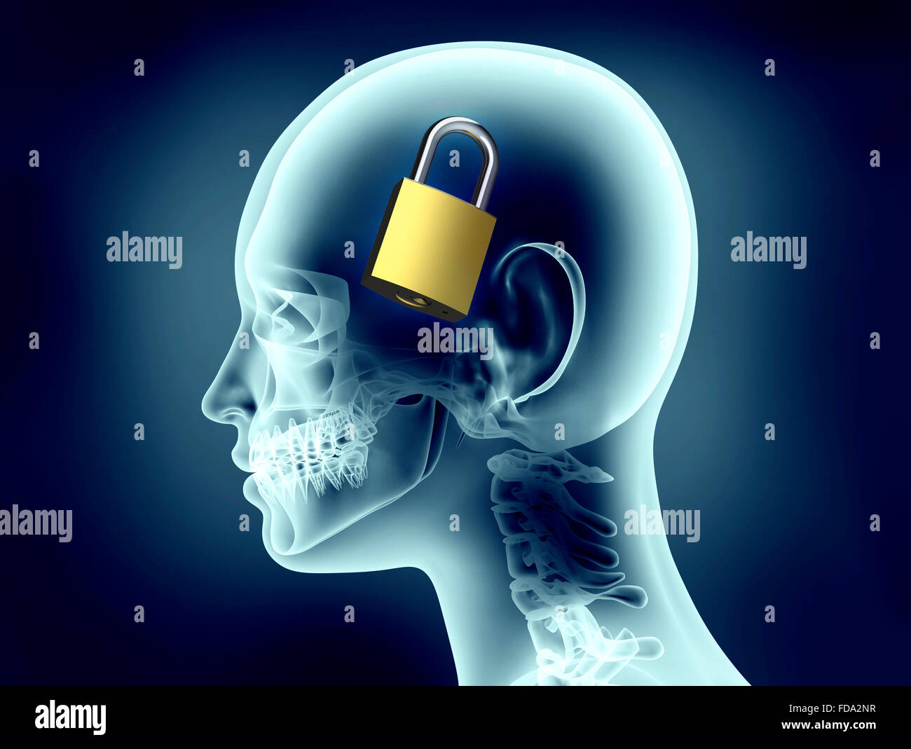 Xray head hi-res stock photography and images - Alamy