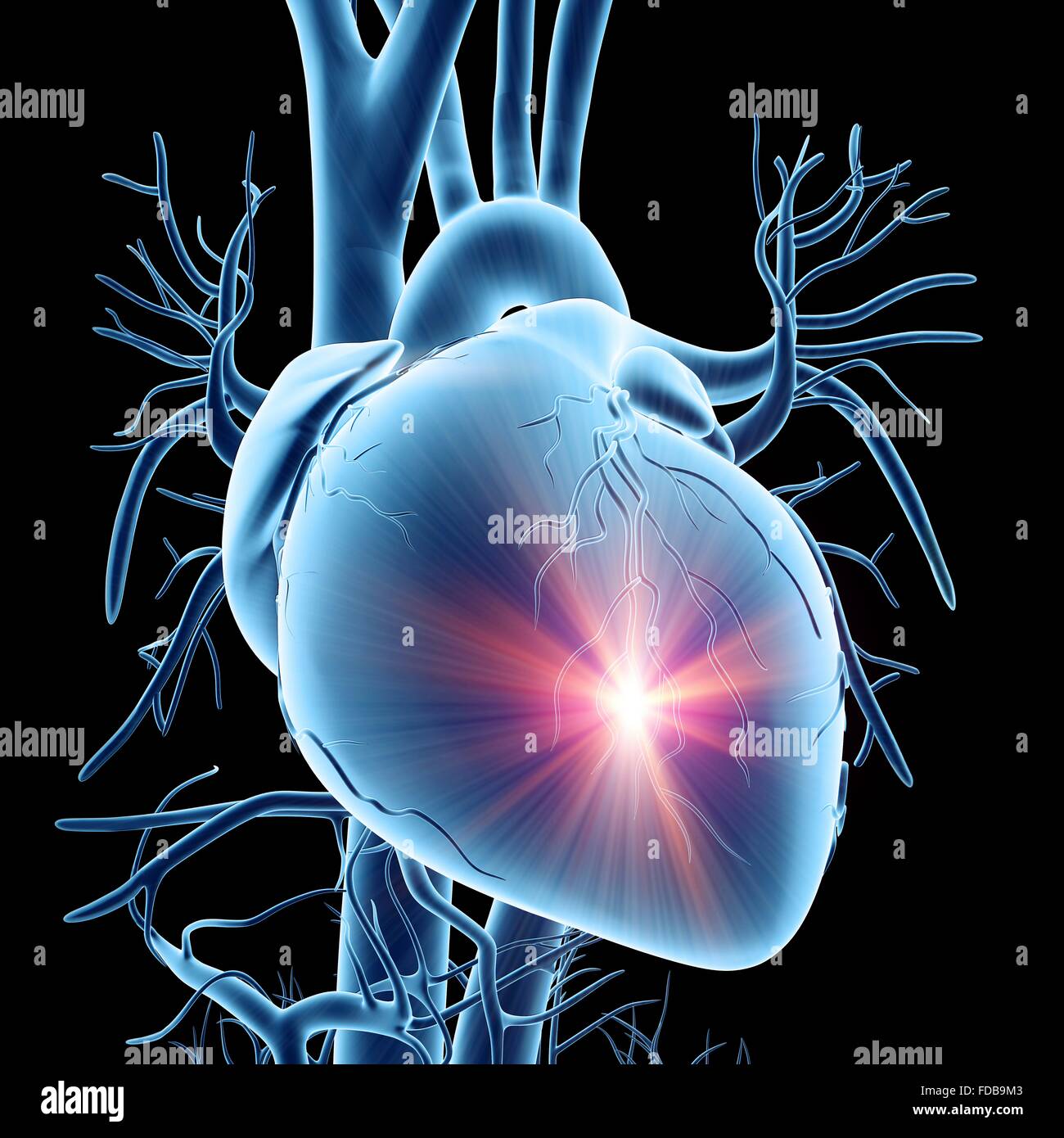 Heart attack cardiac infarction hi-res stock photography and images - Alamy