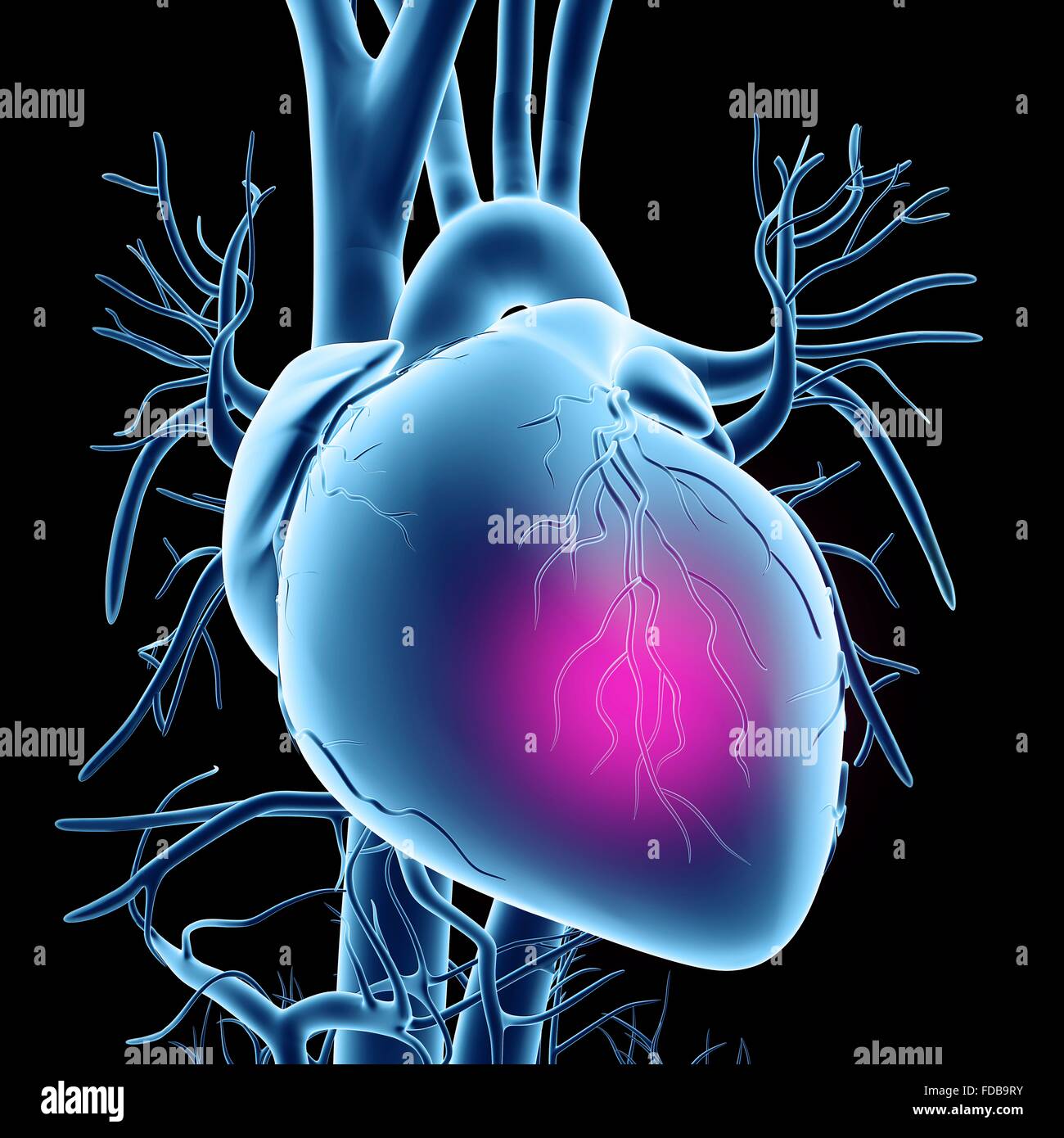 Heart attack, conceptual computer artwork Stock Photo - Alamy
