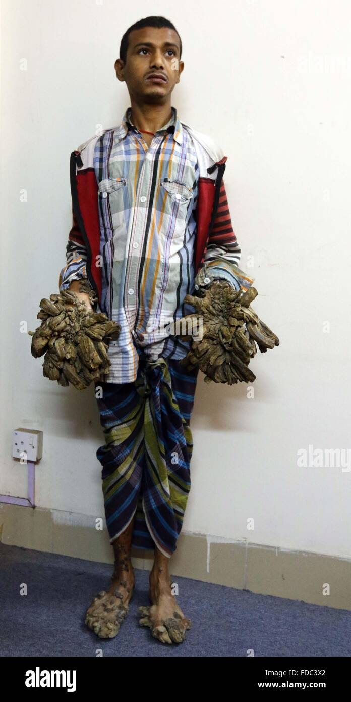 Dhaka 30 January 2016 Abul Bajandar With Tree Like Roots Growing