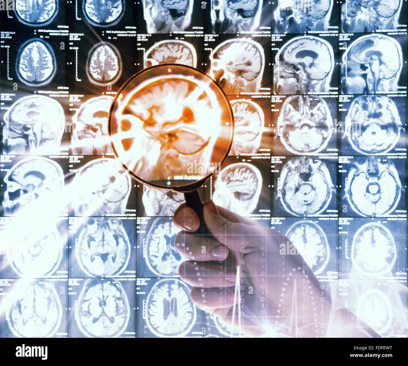 Close up of human hand holding magnifier examining x-ray results Stock ...