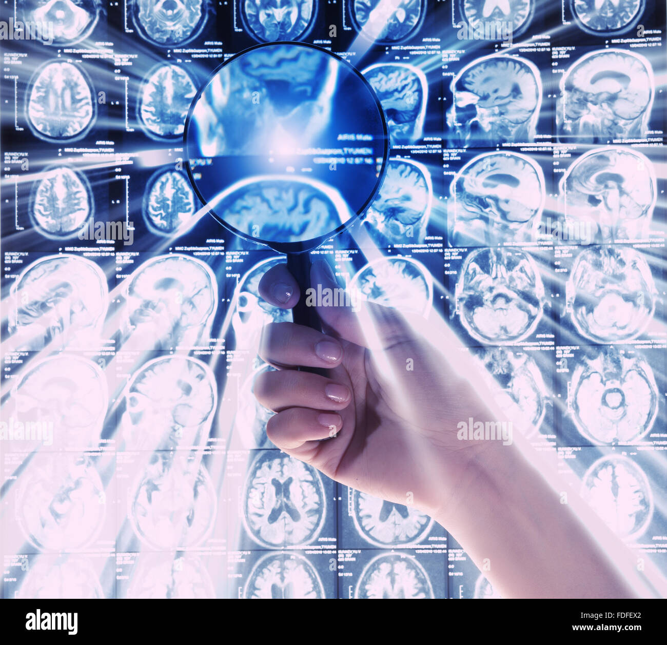 Close up of human hand holding magnifier examining x-ray results Stock ...