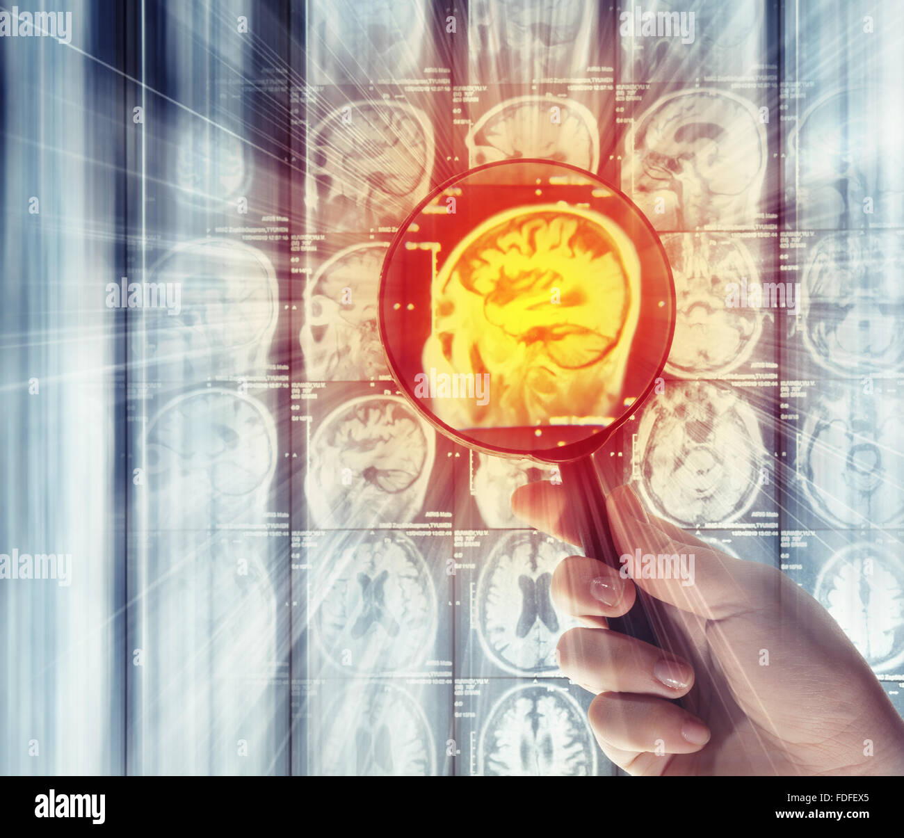 Close up of human hand holding magnifier examining x-ray results Stock ...