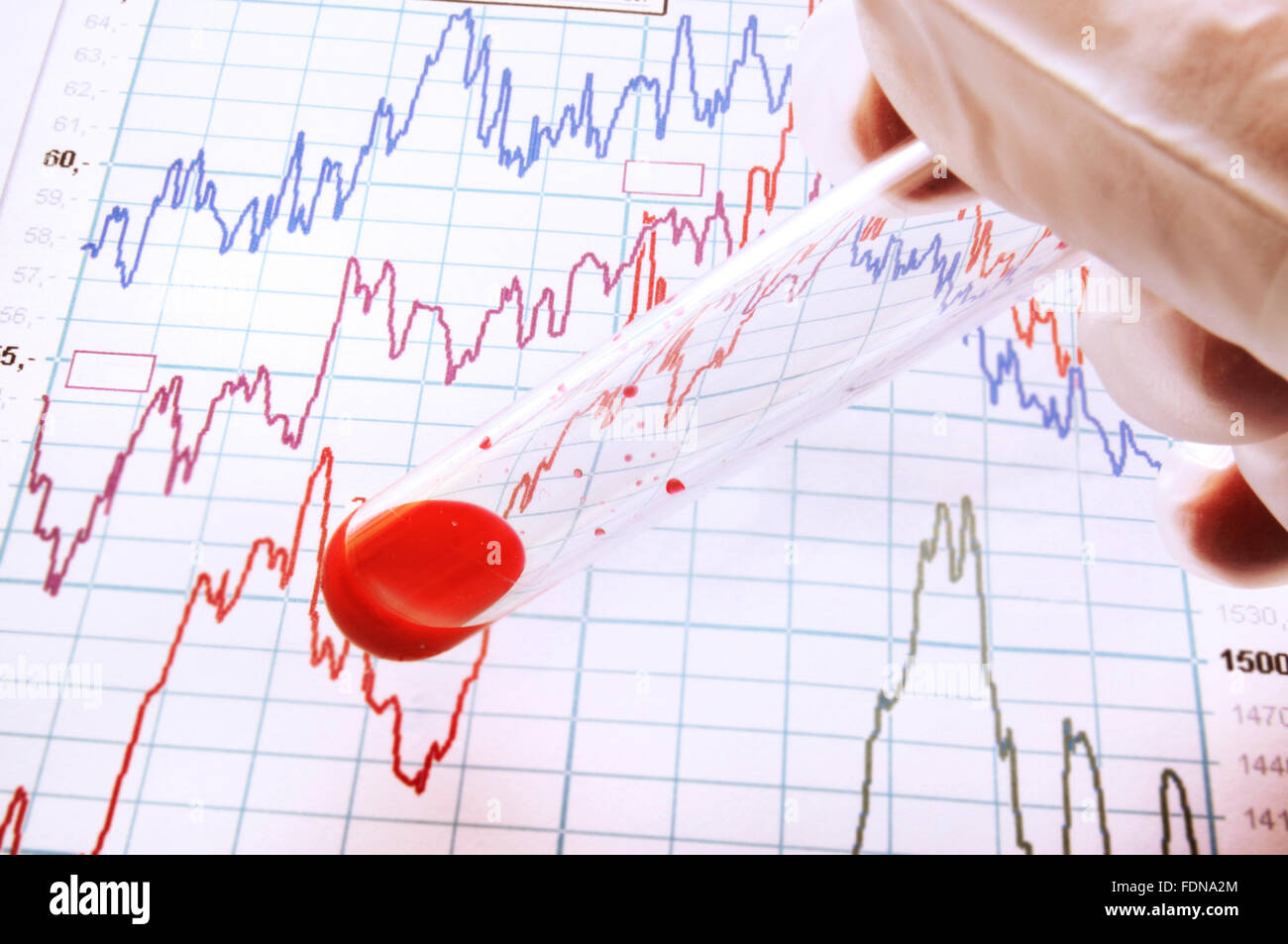 Blood evaluation hi-res stock photography and images - Alamy