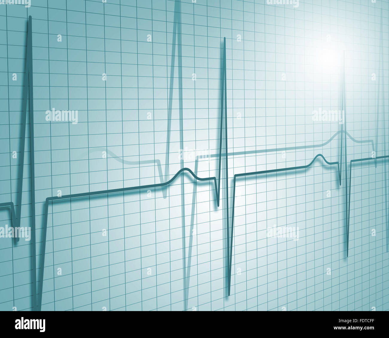 A medical background with a heart beat / pulse with a heart rate ...