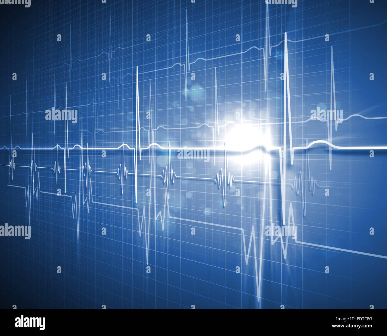 A medical background with a heart beat / pulse with a heart rate ...
