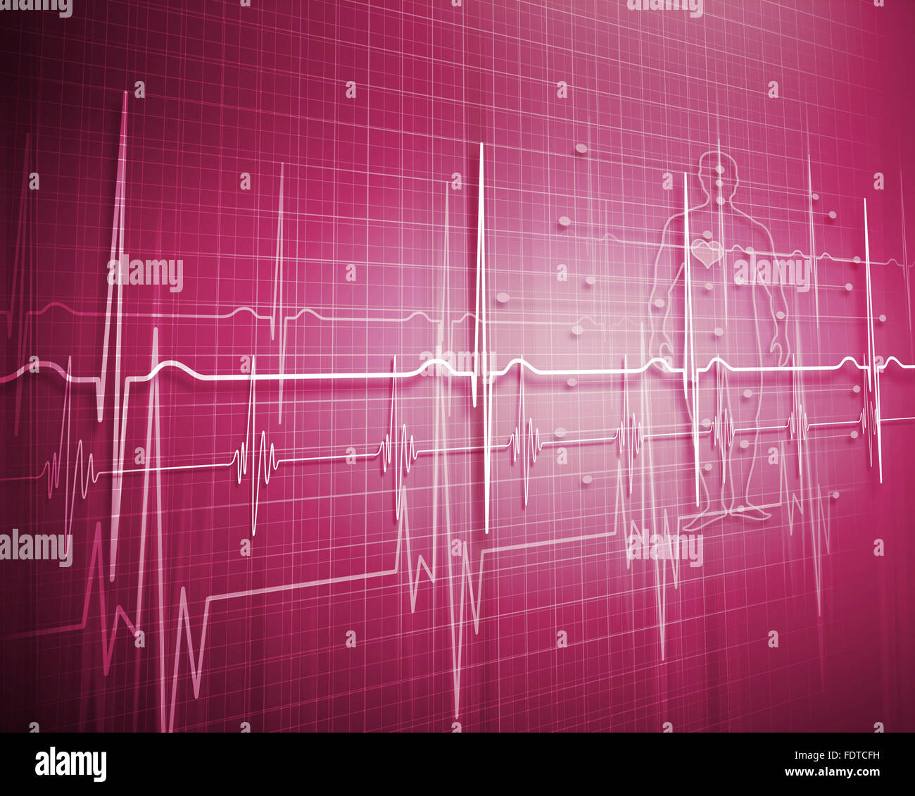 A medical background with a heart beat / pulse with a heart rate ...
