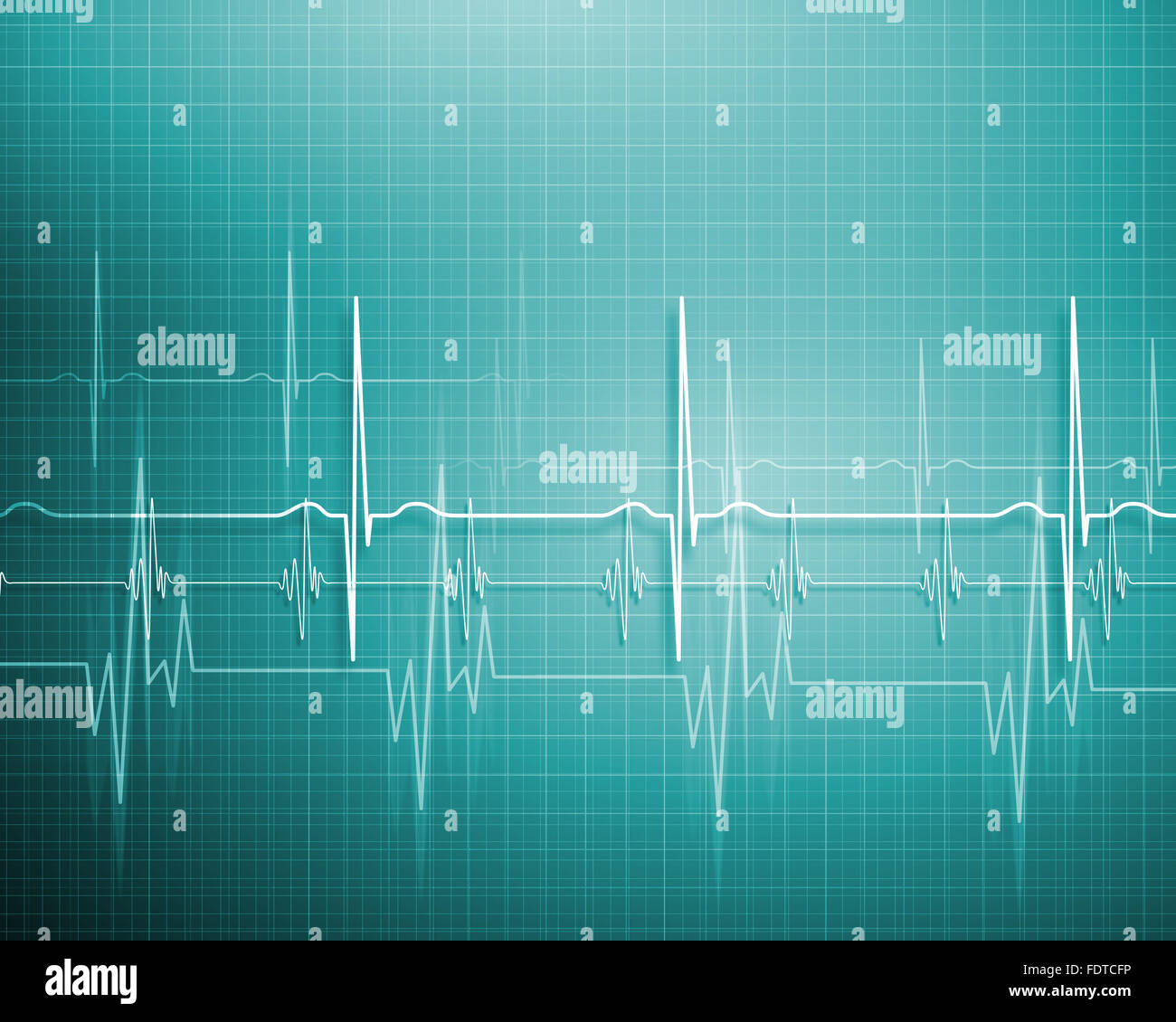 A medical background with a heart beat / pulse with a heart rate ...