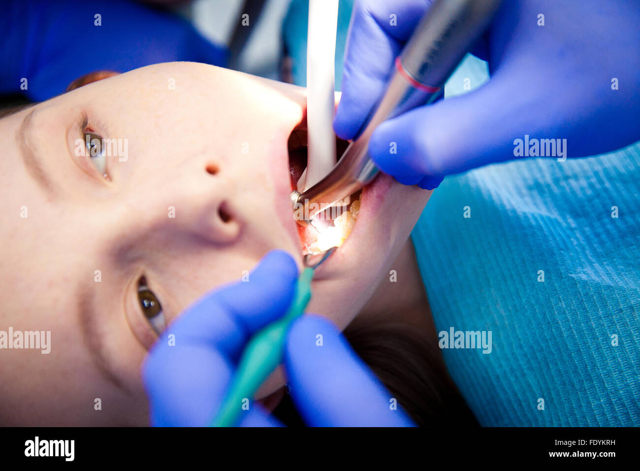 dentist treats teeth Stock Photo - Alamy