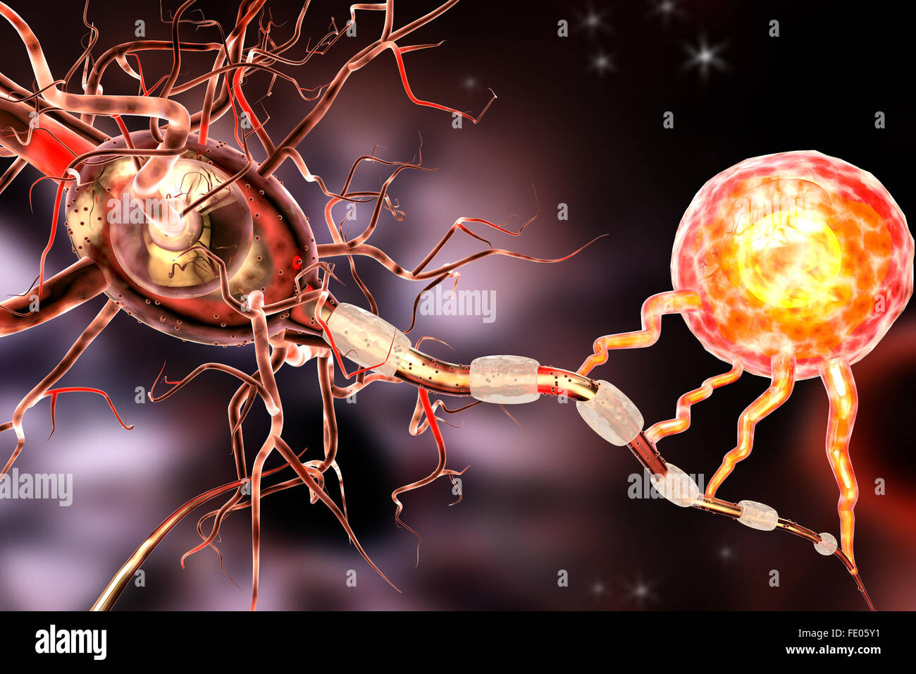 Motor neuron disease hi-res stock photography and images - Alamy