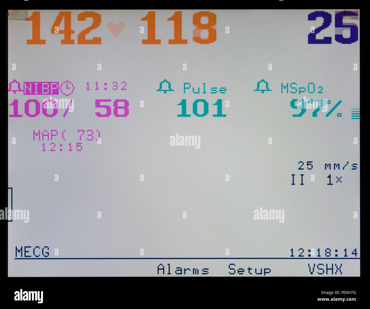 Vital signs hi-res stock photography and images - Alamy