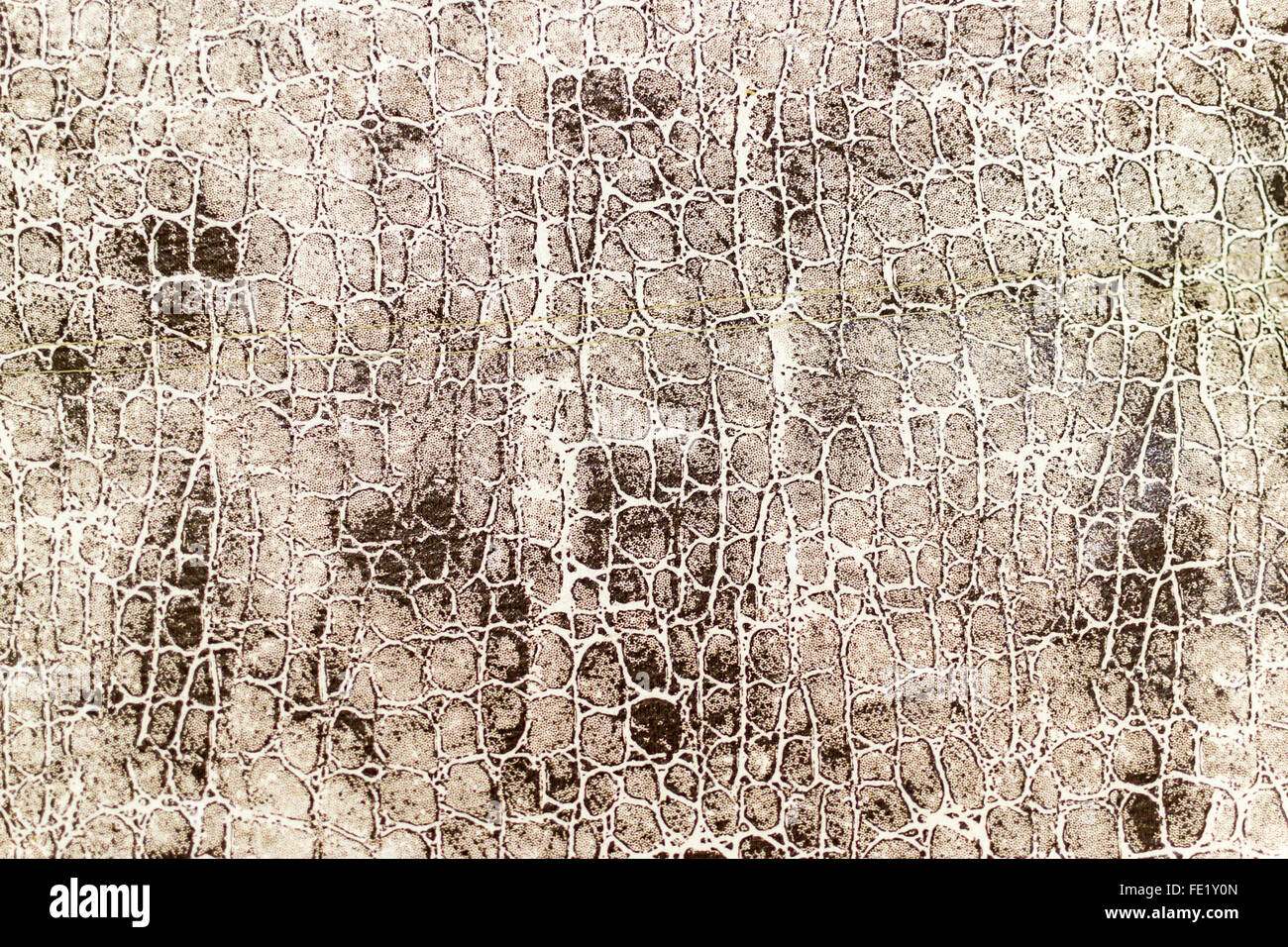 Mottled skin hi-res stock photography and images - Alamy