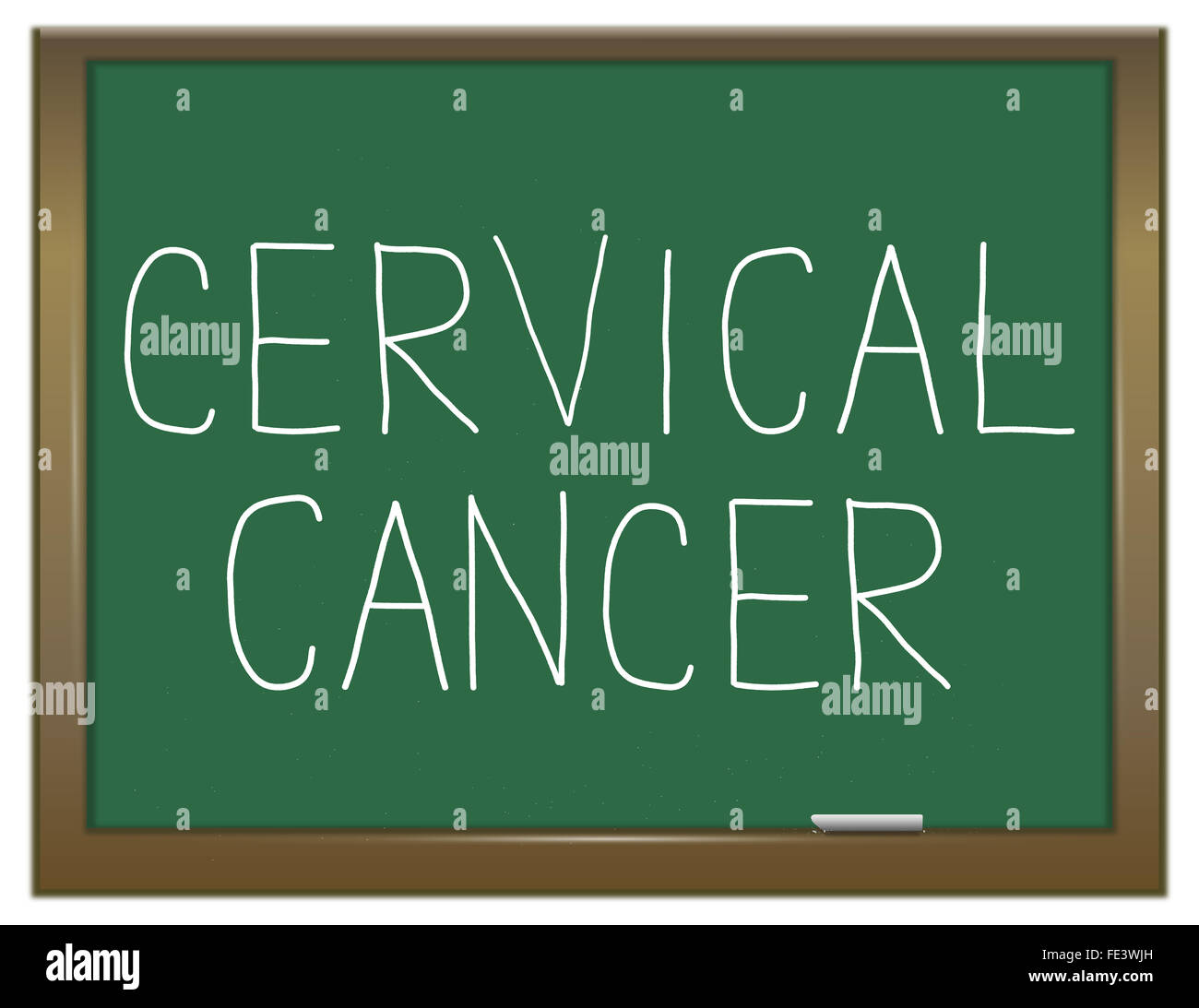 Cervical cancer cells hi-res stock photography and images - Alamy