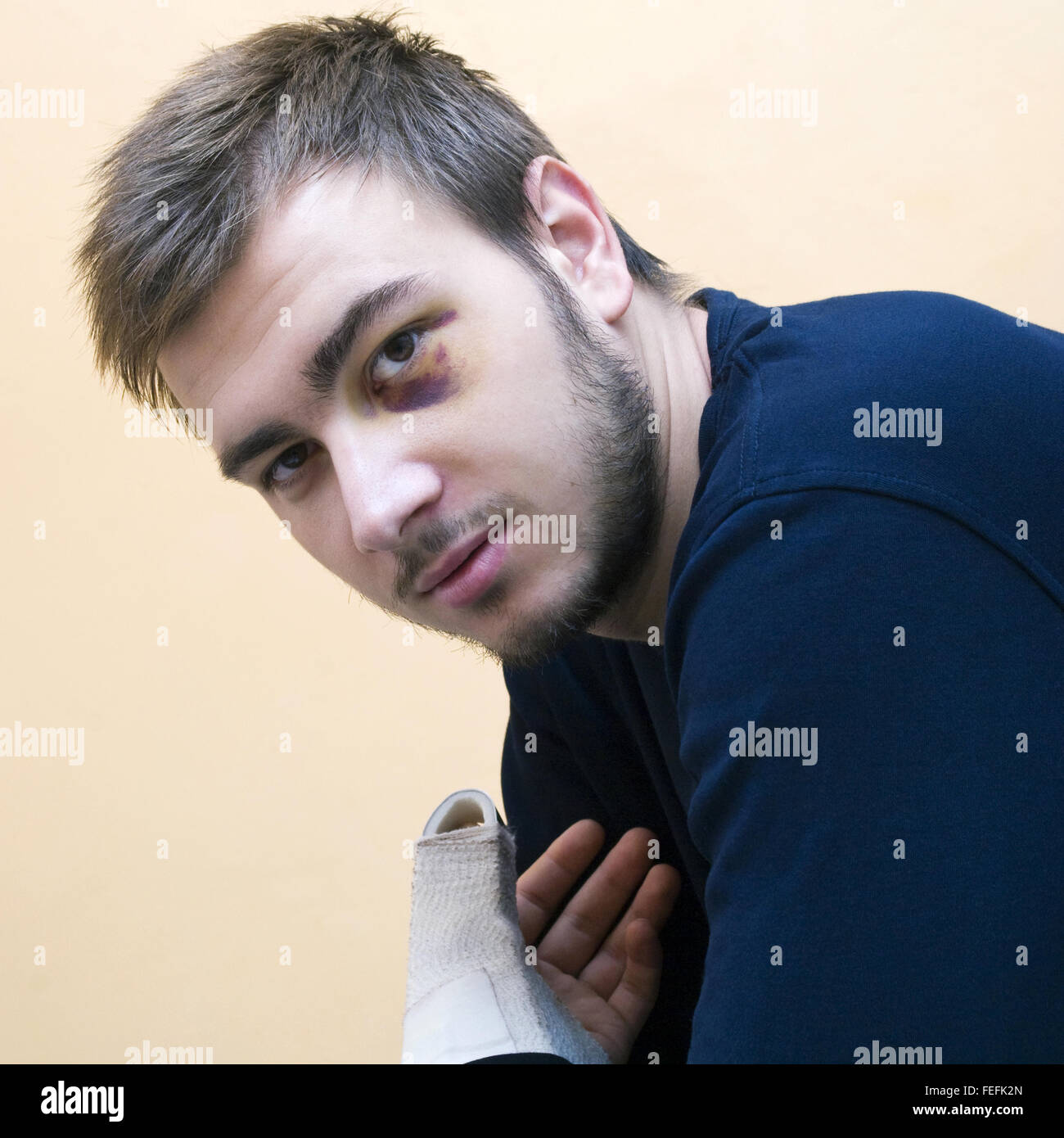 Handsome young man with a shiner. Portrait Stock Photo - Alamy